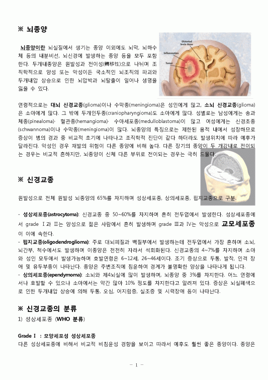 뇌종양 (교모세포종, Glioblastoma)