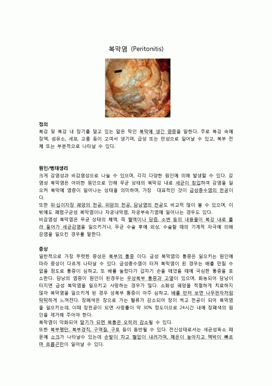 ICU 에서 주로 쓰이는 진단명, 약물, 기계에 관하여 (복막염 (Peritonitis), 호흡 부전증(Respiratory failure), 급성 심장 마비 (Sudden Cardiac arrest), 실습지(ICU) 대표 약물, ventilator, ventilator의 Mode)