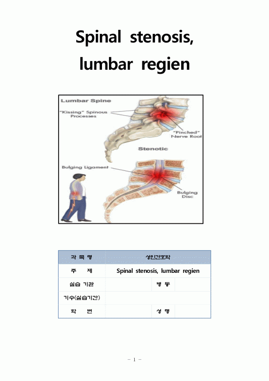 척추관 협착증 Spinal stenosis -받은 자료입니다.