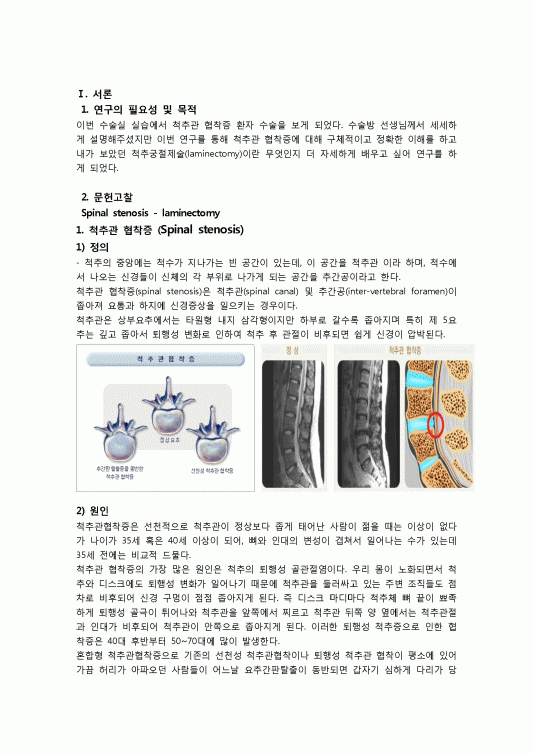 + 문헌고찰 + 척추협착증 케이스스터디 , 수술실 케이스스터디